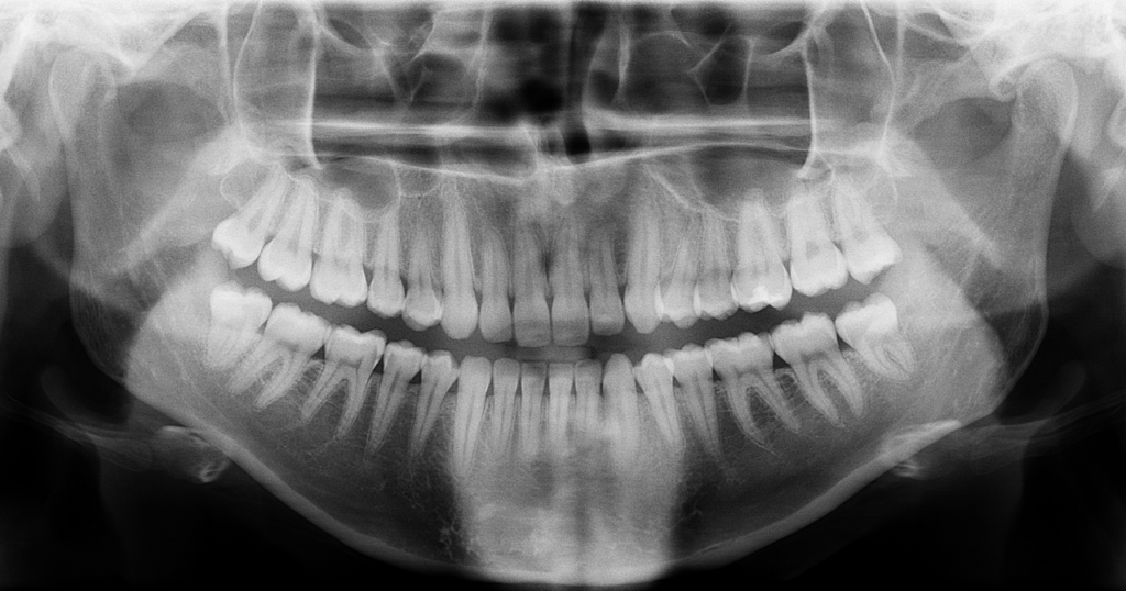 Dentina - Pantomogram, RVG - Stomatolog Urszula Gralewska.